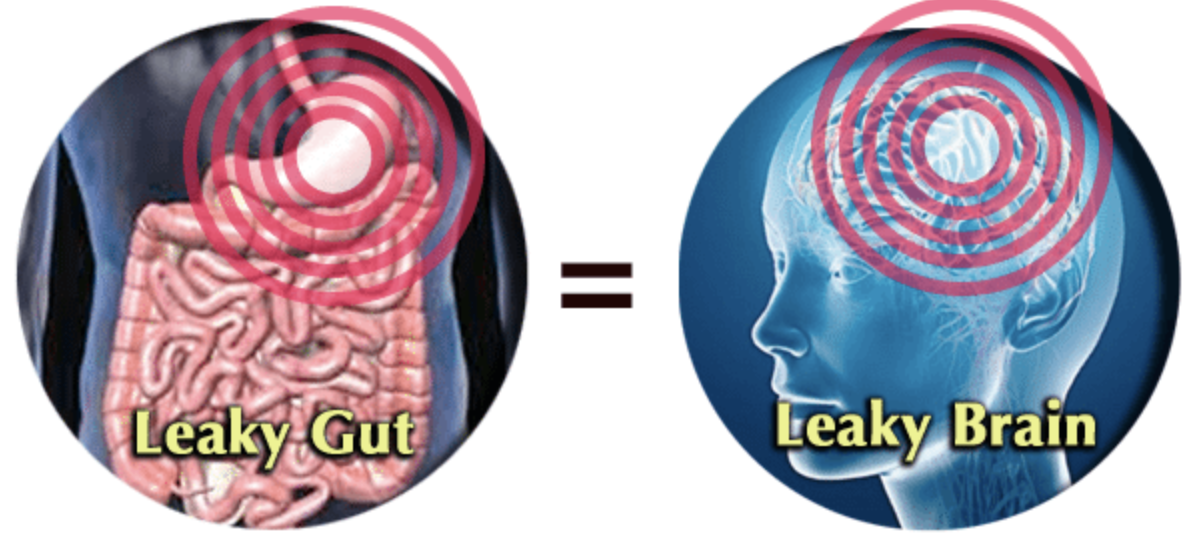 Do You have 'Leaky Brain'? - B Better